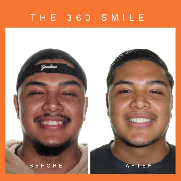 360 Orthodontics: Affordable Braces & Invisalign in LA