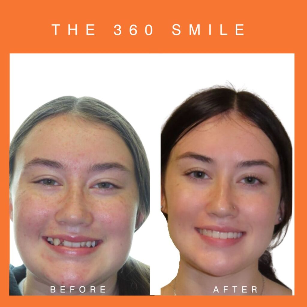 360 Orthodontics: Affordable Braces & Invisalign in LA